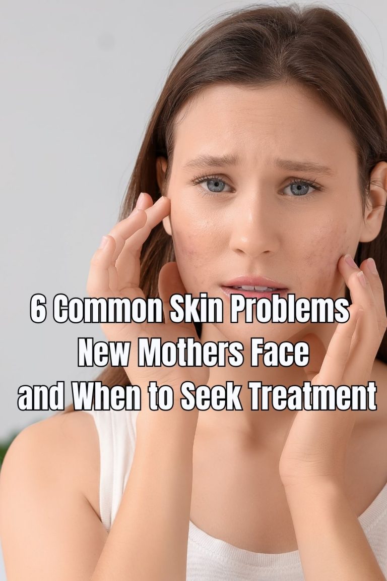 6 Common Skin Problems New Mothers Face and When to Seek Treatment ...