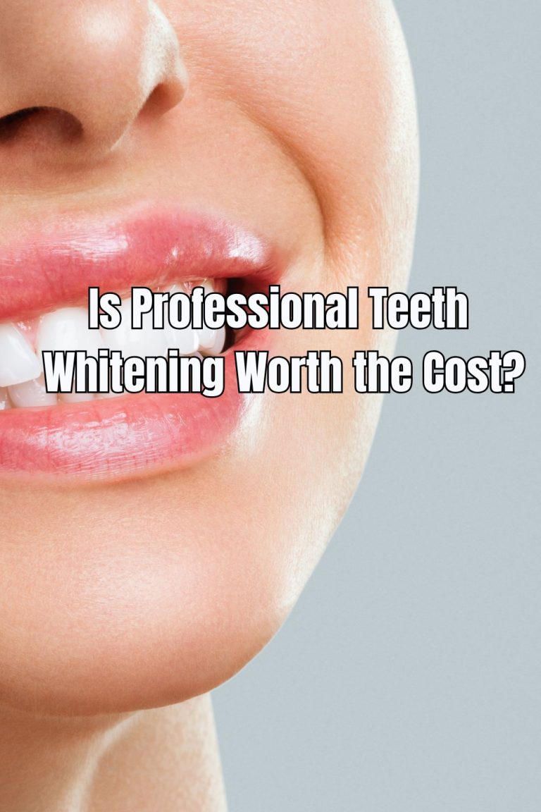 Is Professional Teeth Whitening Worth the Cost? - ConservaMom